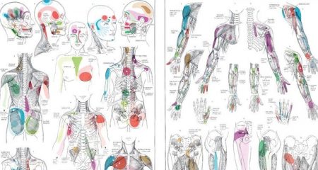 Muscle Knots Archives - Myofascial Pain Solutions